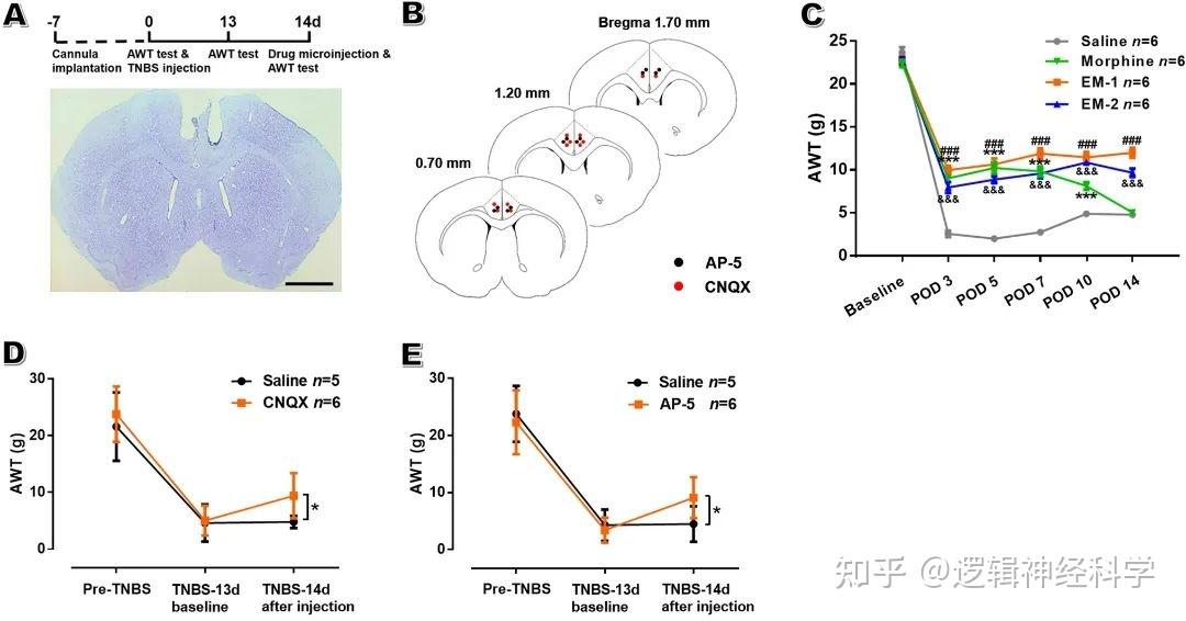 Neurosci Bull︱李云庆课题组揭示前扣带回内神经可塑性改变与慢性胰腺炎的痛觉过敏和焦虑有关 - 知乎
