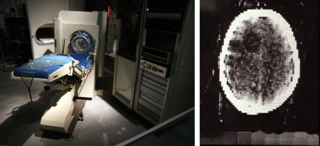 收藏！全球CT技术变迁史 - 知乎