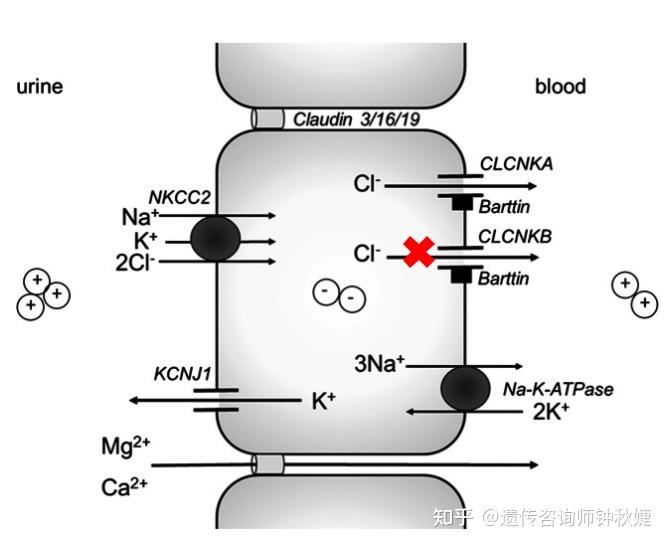 Bartter综合征：孩子长不高，可能是这种代谢病在作怪 - 知乎