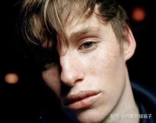 为何西方人以雀斑为美？东方审美以它为瑕疵？为何差异这么大？ - 知乎