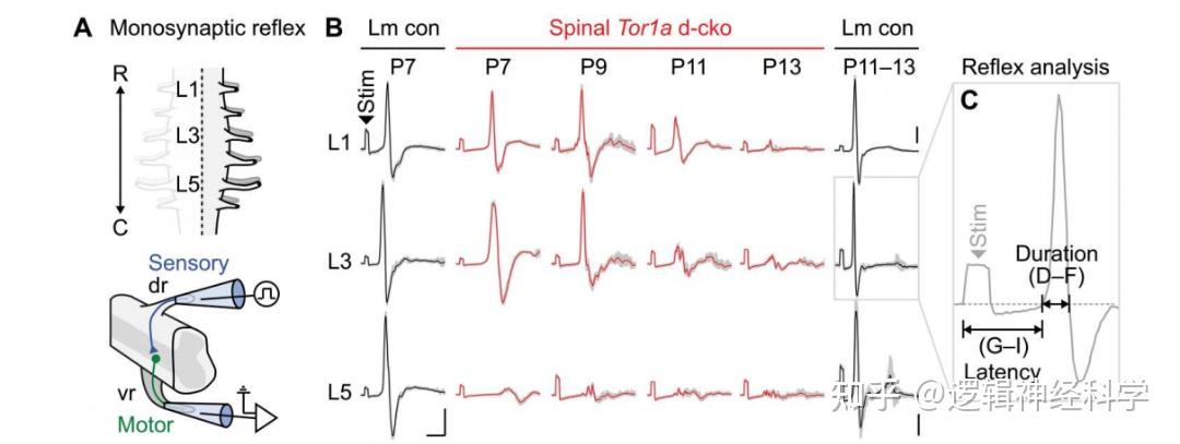 STM︱伦敦大学学院团队发现脊髓神经回路功能障碍介导的Dyt1-Tor1a肌张力障碍小鼠的病理发生机制 - 知乎