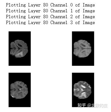 医学影像深度学习系列（六）- 了解MRI（上）-多通道3D图像 - 知乎