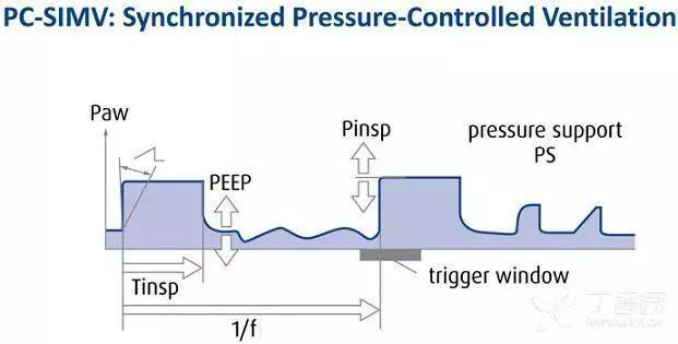 呼吸机操作入门看这篇就够了 - 知乎