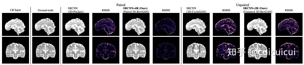 生成对抗网络系列——CVPR2019中的图像转化GAN - 知乎
