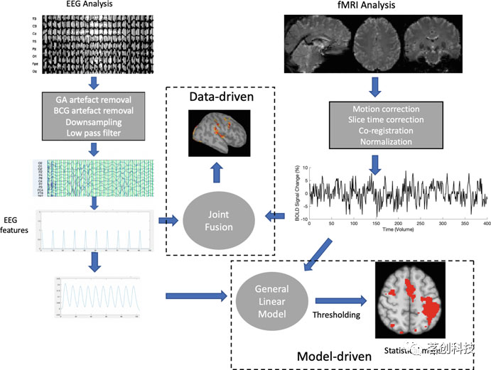 多模态神经成像之EEG-fMRI同步 - 知乎