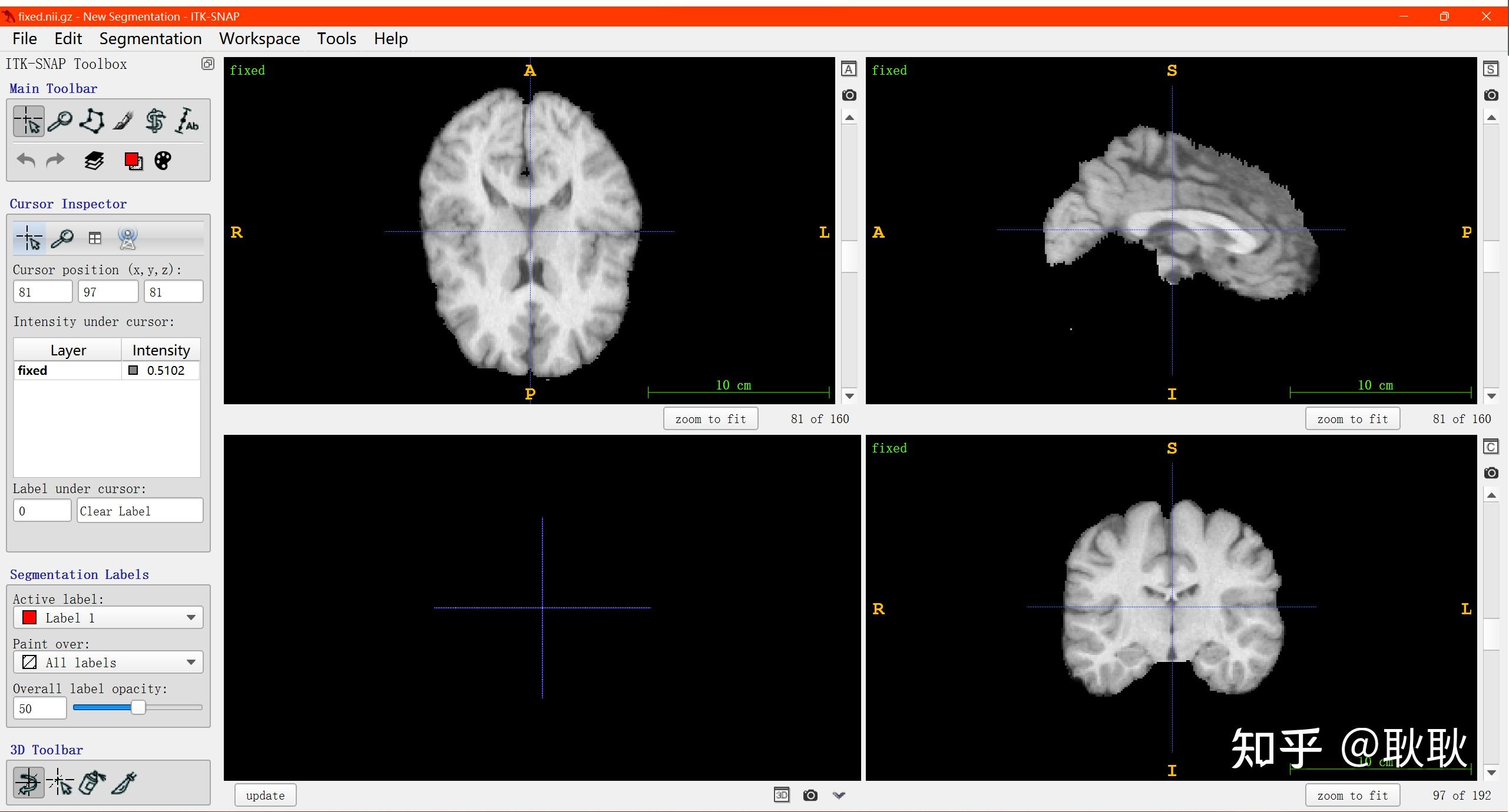 [论文笔记] VoxelMorph - 知乎