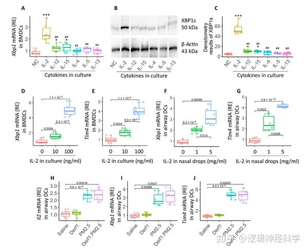 Sci Signal︱深圳大学杨平常团队阐明XBP1-TIM4信号轴在过敏性气道炎症中的分子机制 - 知乎