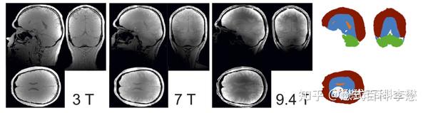 MRI基础知识——SNR与场强的关系 - 知乎