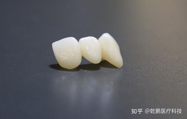 procera瑞典瓷全瓷牙有哪些优势？ - 知乎