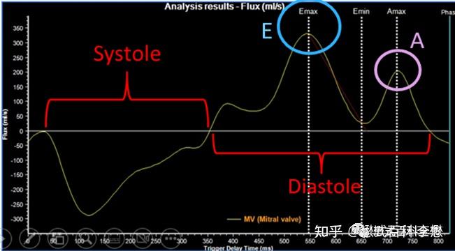 什么叫E/A ratio E/A比值 - 知乎