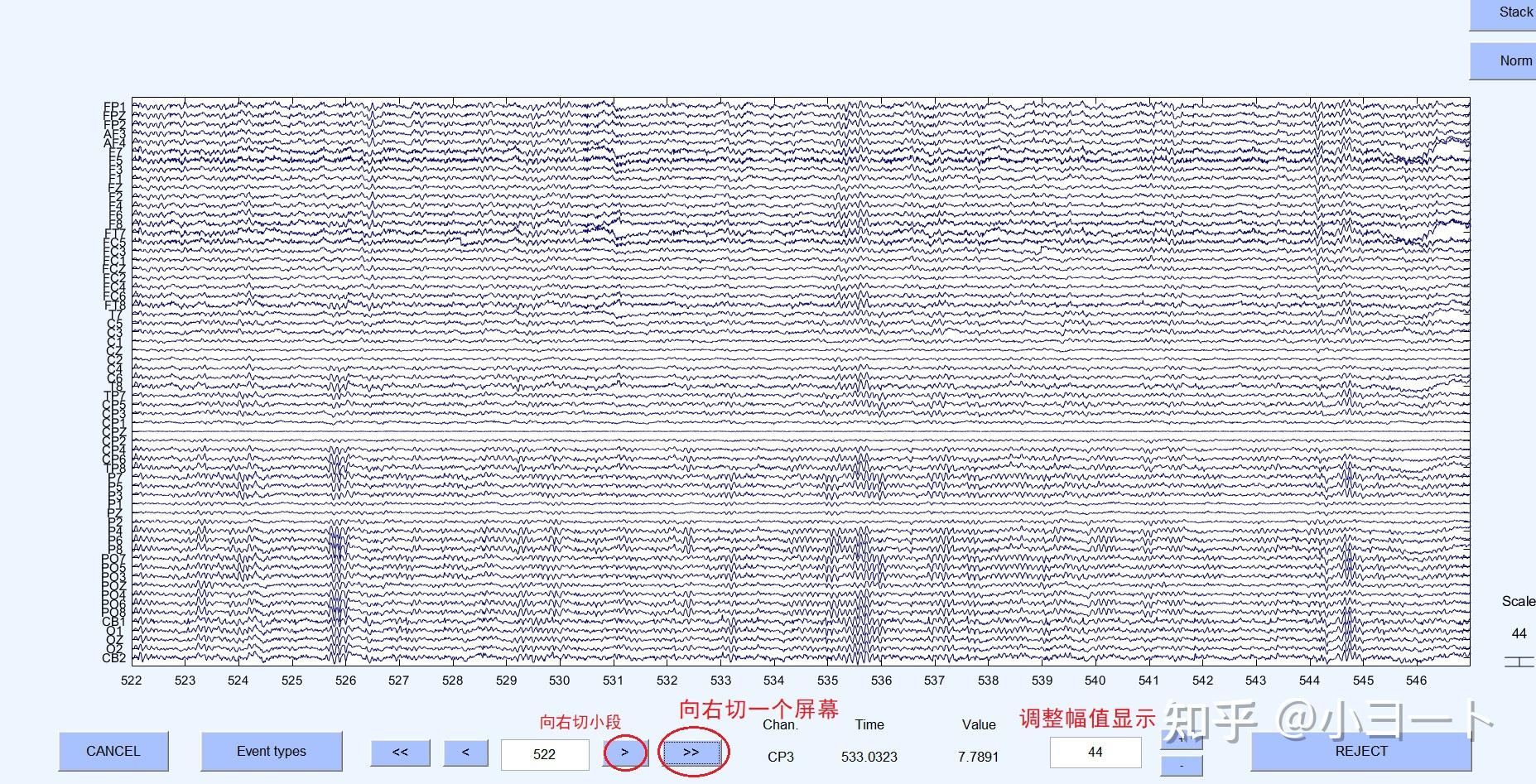 手把手系列教程||使用EEGLAB2023版对脑电数据进行预处理 - 知乎
