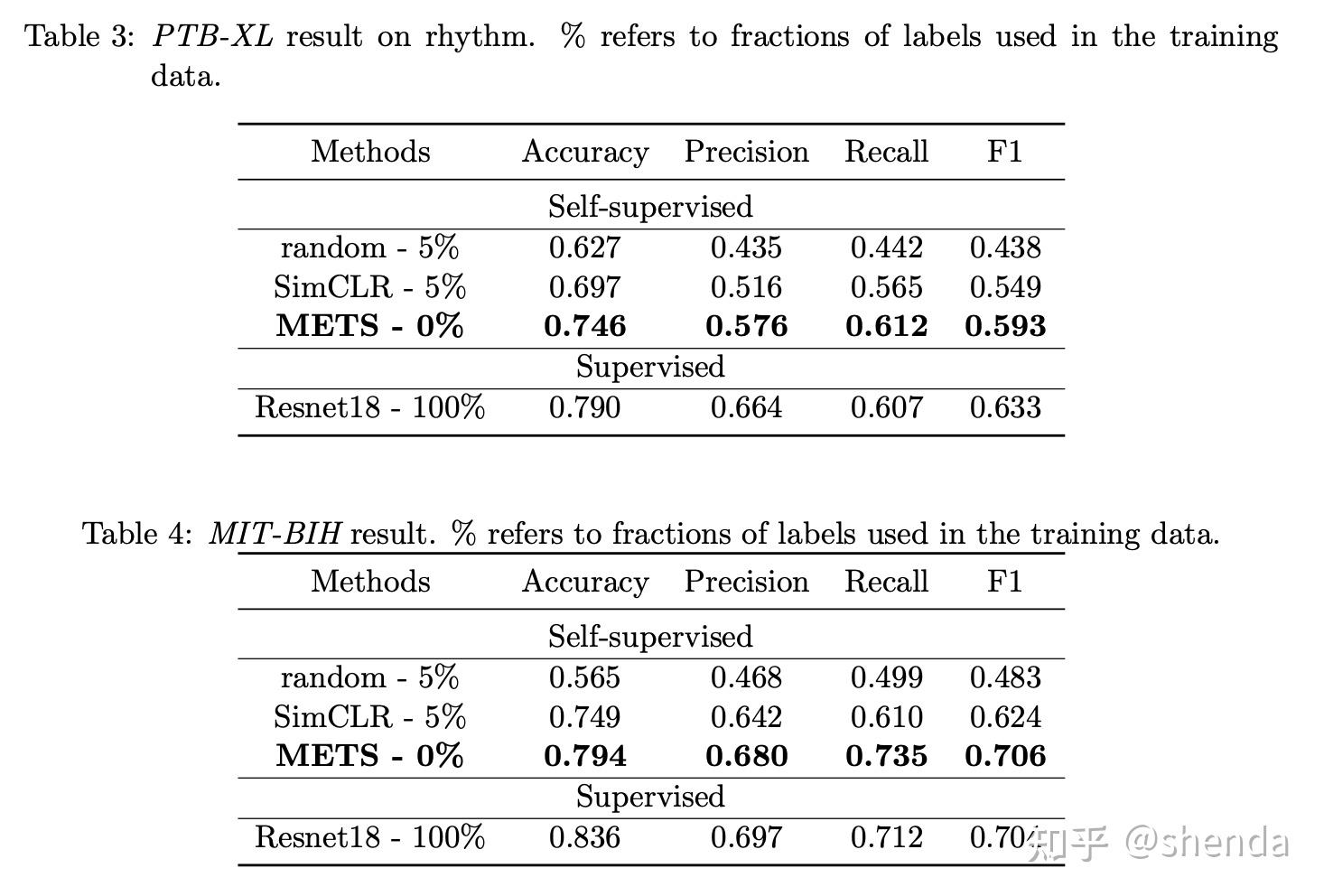 [MIDL 2023] 利用语言模型帮助心电信号零样本学习 - 知乎