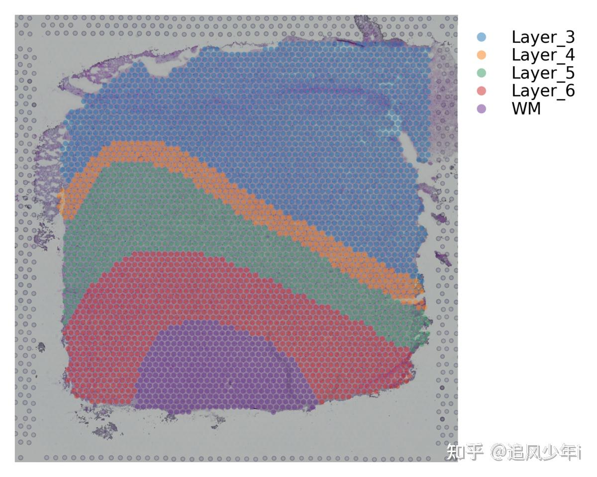 10X单细胞空间回顾之stlearn - 知乎