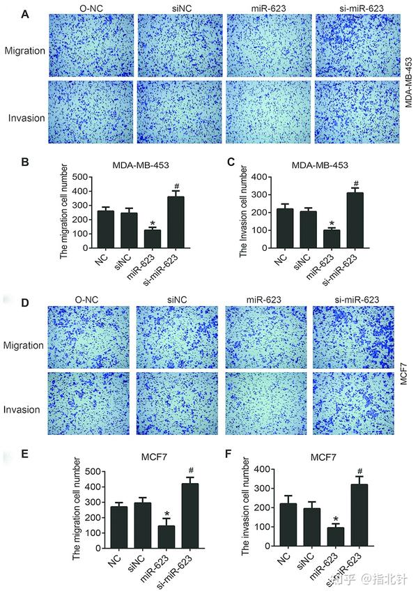 Transwell实验——原理、步骤、注意事项、示例图 - 知乎