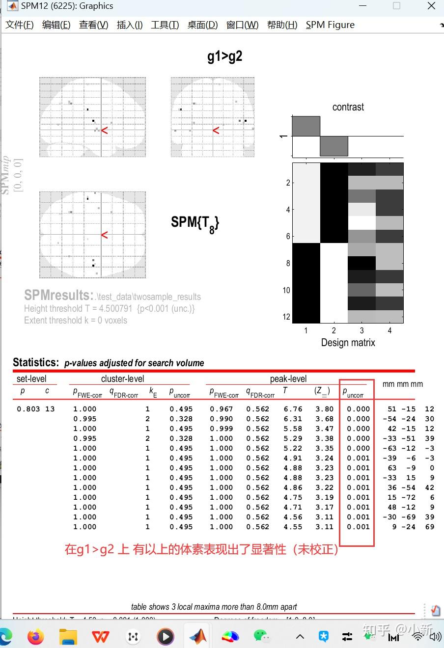 9-SPM-fmri任务态 二阶分析： 双样本t检验 - 知乎