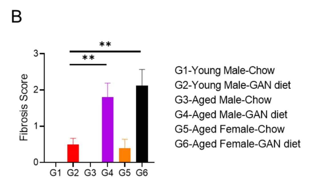 GAN饮食诱导NASH模型 | 老龄鼠再展新风采，助力NASH药物研发 - 知乎