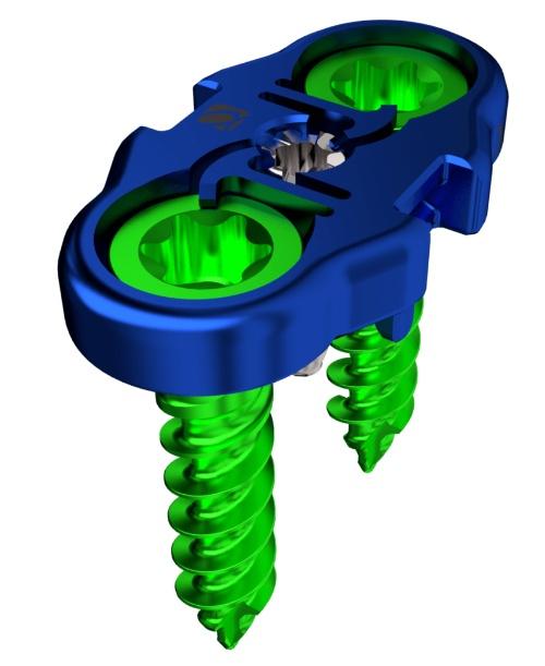 与医生协作开发，脊柱公司Alphatec - 知乎