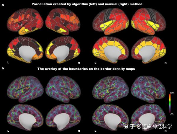 NeuroImage︱浙江大学吴丹课题组发布基于新生儿多模态影像数据的多尺度分割脑区模板 - 知乎