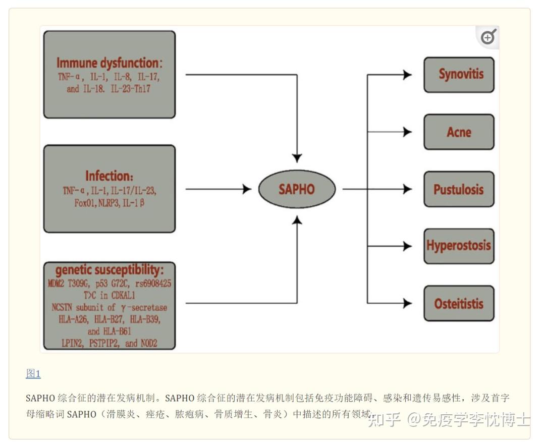 SAPHO综合征的药物治疗研究进展！ - 知乎