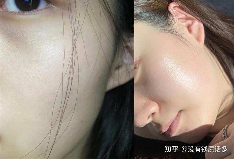 日常吃什么能让皮肤变好？ 知乎