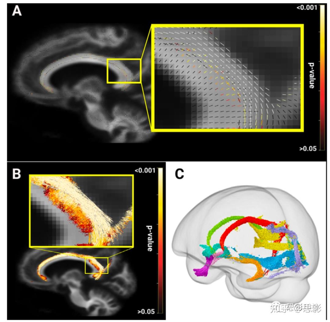基于扩散磁共振成像的FBA（Fixel-Based Analysis）分析 - 知乎