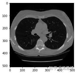 处理医疗影像的Python利器：PyDicom - 知乎