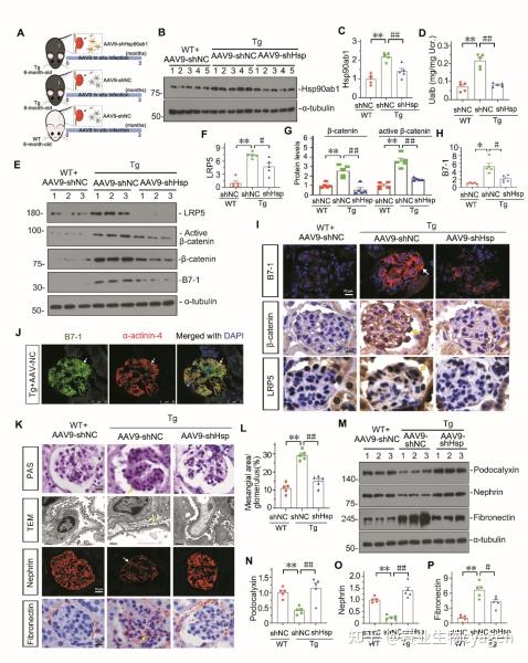 南方医院发现足细胞损伤的重要机制，有望改善靶向B7-1的肾病疗法 - 知乎