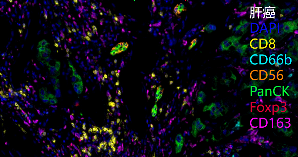 多色免疫组化 - 知乎