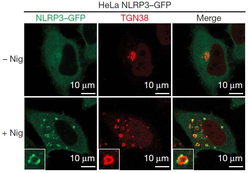 Nature丨陈志坚组解开困扰学界多年的关于NLRP3炎症小体激活之谜 - 知乎