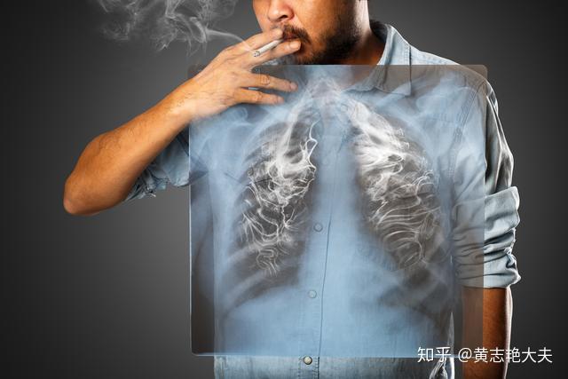 为什么必须要戒烟?这才是大实话!戒烟永远都不晚,20分钟就获益 知乎