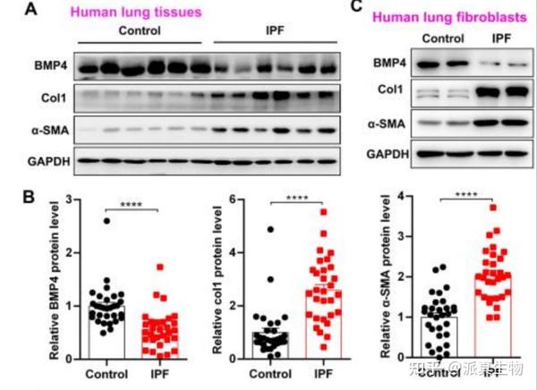 何建行/卢文菊团队：骨形态发生蛋白4 (BMP4)通过调节肺成纤维细胞的衰老和线粒体自噬抑制肺纤维化！ - 知乎