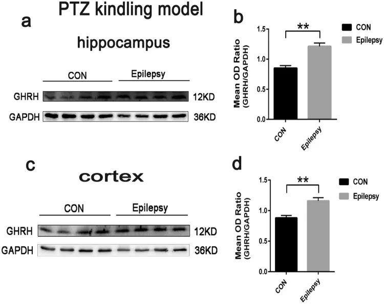 疾病模型 | 癫痫动物模型 - 知乎
