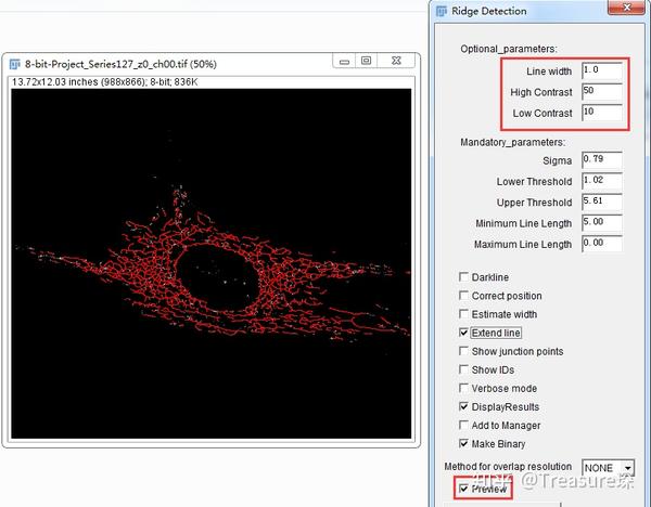 ImageJ实用技巧——线粒体网络形态分析(插件篇) - 知乎