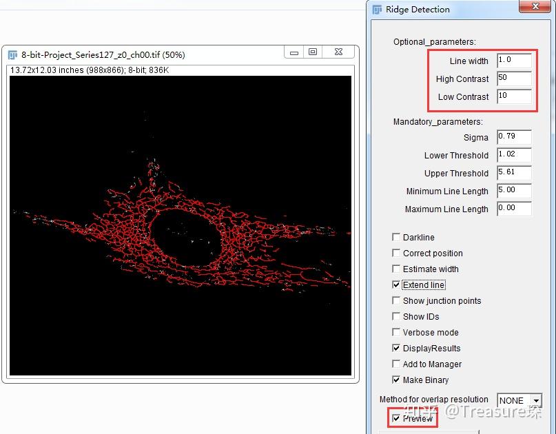 ImageJ实用技巧——线粒体网络形态分析(插件篇) - 知乎