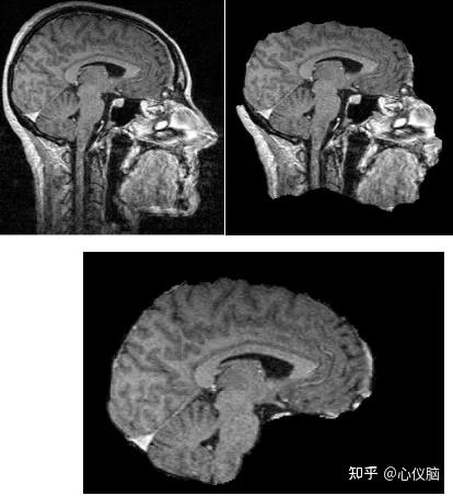 利用FSL进行核磁数据处理(使用GUI/代码) - 知乎