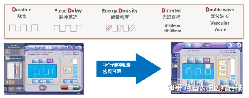 M22 AOPT超光子合集（全） - 知乎