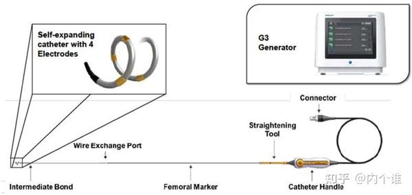 【行业资讯】Symplicity Spyral肾去神经系统FDA审评过程 - 知乎