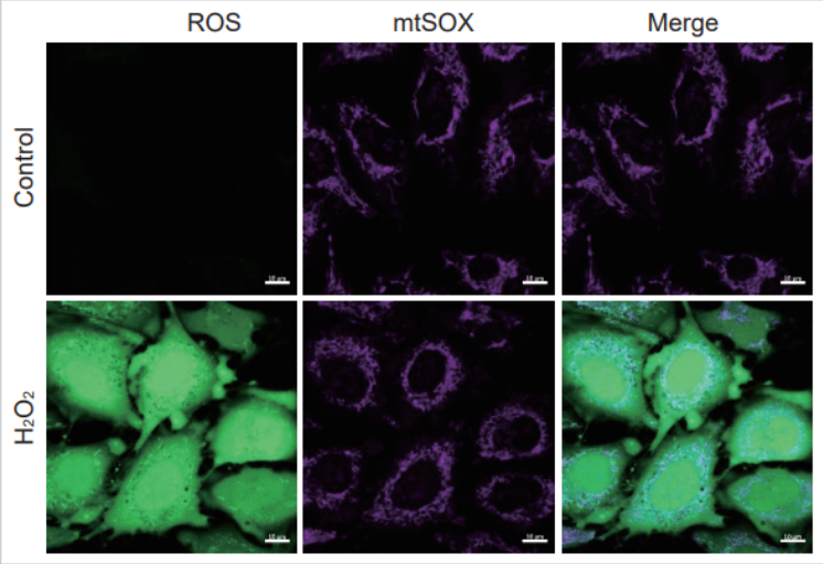 铁死亡与线粒体 - 知乎