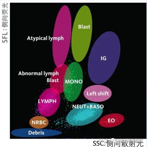 【临检基本功】如何看懂血细胞直方图与散点图（建议收藏） - 知乎