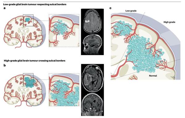 Nat Rev Neurosci重要综述：脑血管系统研究进入单细胞时代 - 知乎