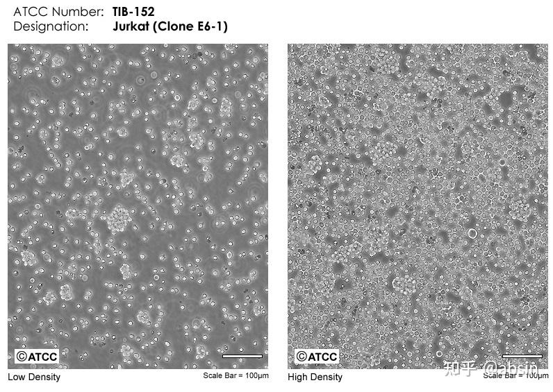Jurkat（Clone E6-1）细胞培养攻略 - 知乎