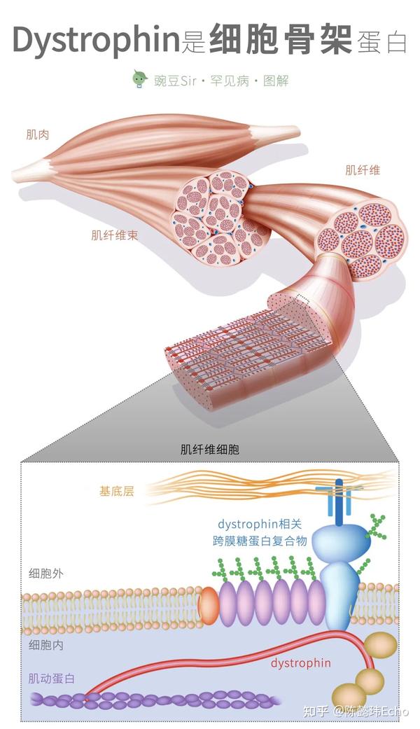 Duchenne型肌营养不良：老病新知，孕育希望｜医者仁心 - 知乎