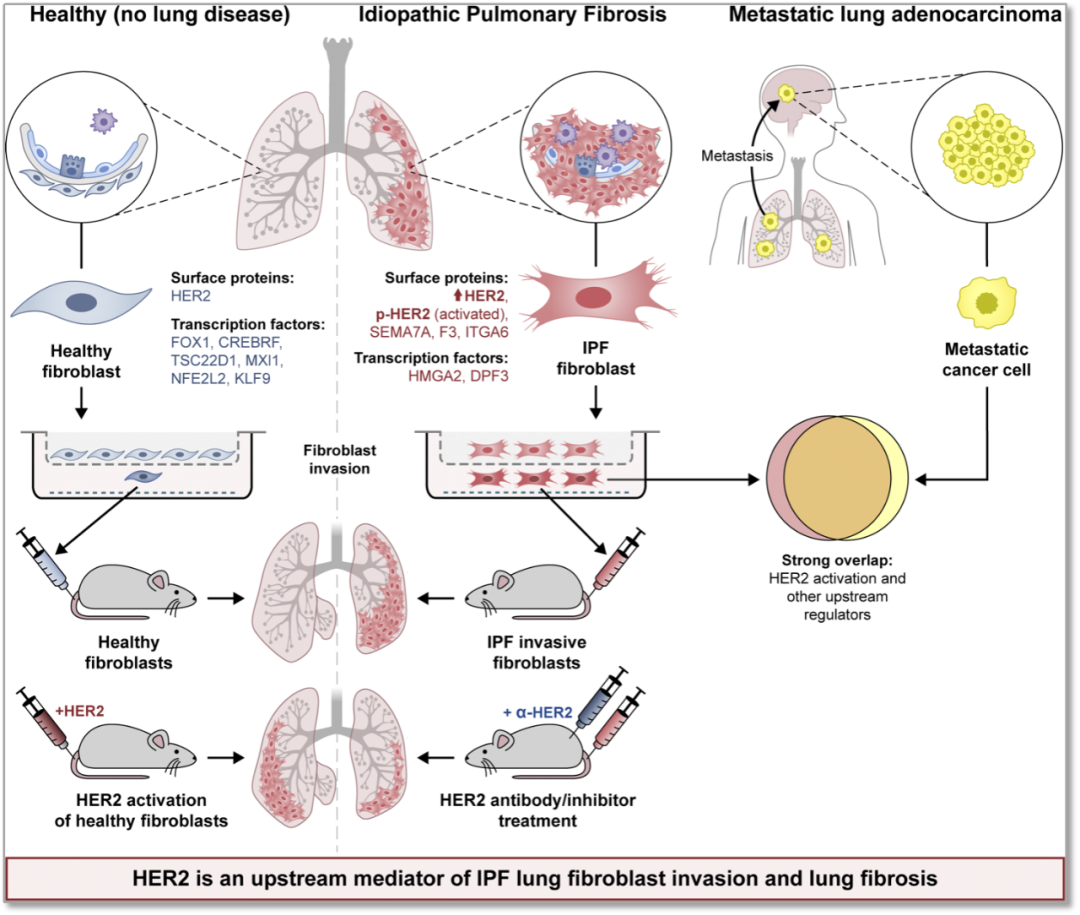 J Exp Med︱蒋典华团队揭示HER2是调控肺成纤维细胞侵袭和肺纤维化新靶点 - 知乎