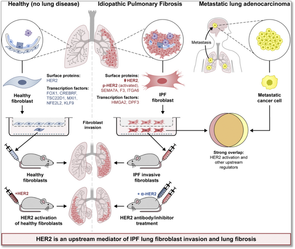 J Exp Med︱蒋典华团队揭示HER2是调控肺成纤维细胞侵袭和肺纤维化新靶点 - 知乎