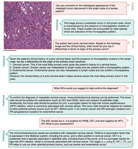 深度洞察｜ 病理基础大模型的前世今生（下） - 知乎
