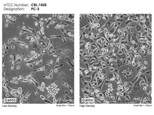 PC-3细胞培养，人前列腺癌细胞培养攻略 - 知乎