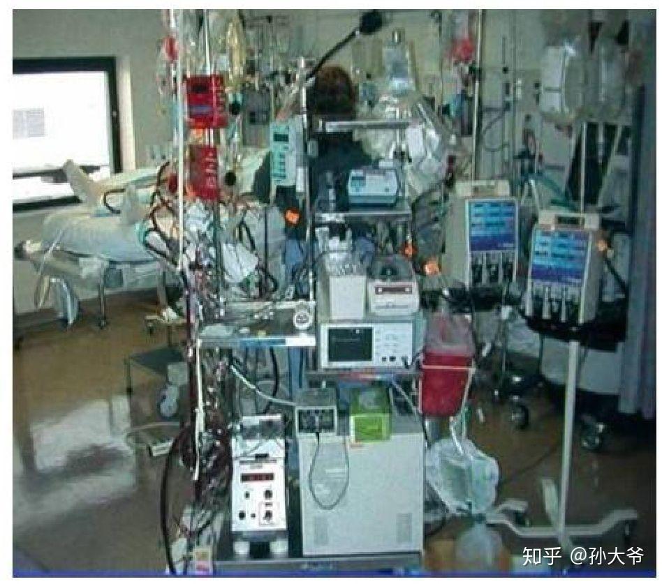 来吧，写个给普通人看的ECMO介绍 - 知乎