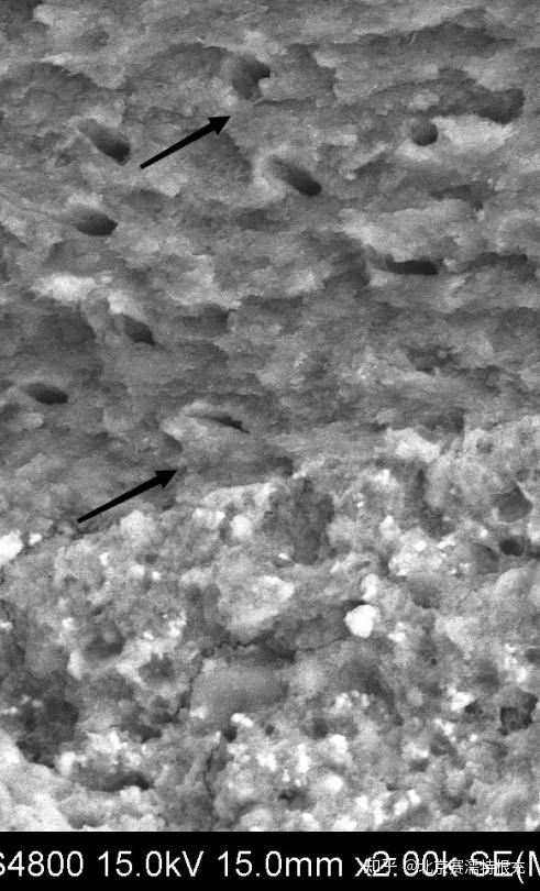 C-Root SP硅酸锶，口腔人理想的根管充填糊剂！ - 知乎