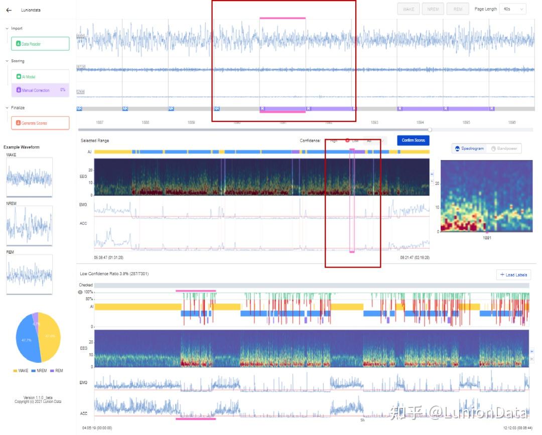 睡眠分期 | Lunion Stage 2分钟视频教程 - 知乎