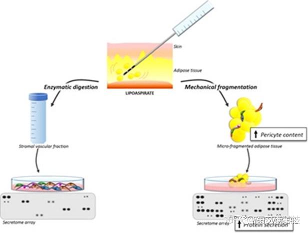 FDA ? SVF ? 一分钟了解国内外高端医疗名词 - 知乎